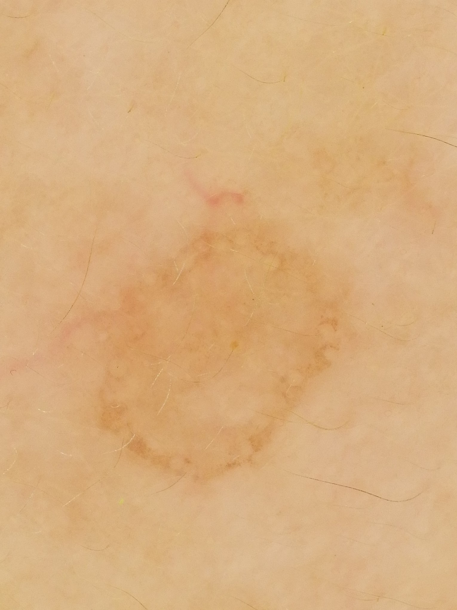 さて診断は？ | シャルムクリニックBlog